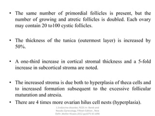 Polycystic ovarian syndrome | PPTX