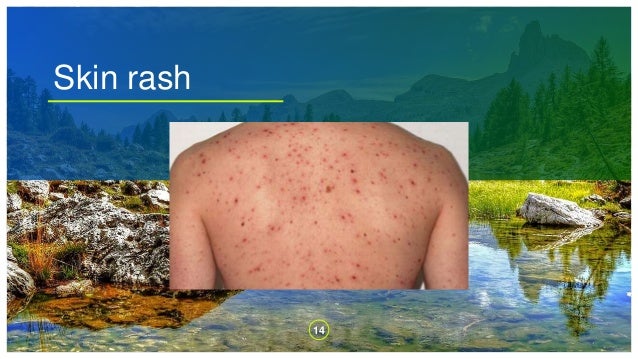 Xeljanz side effects