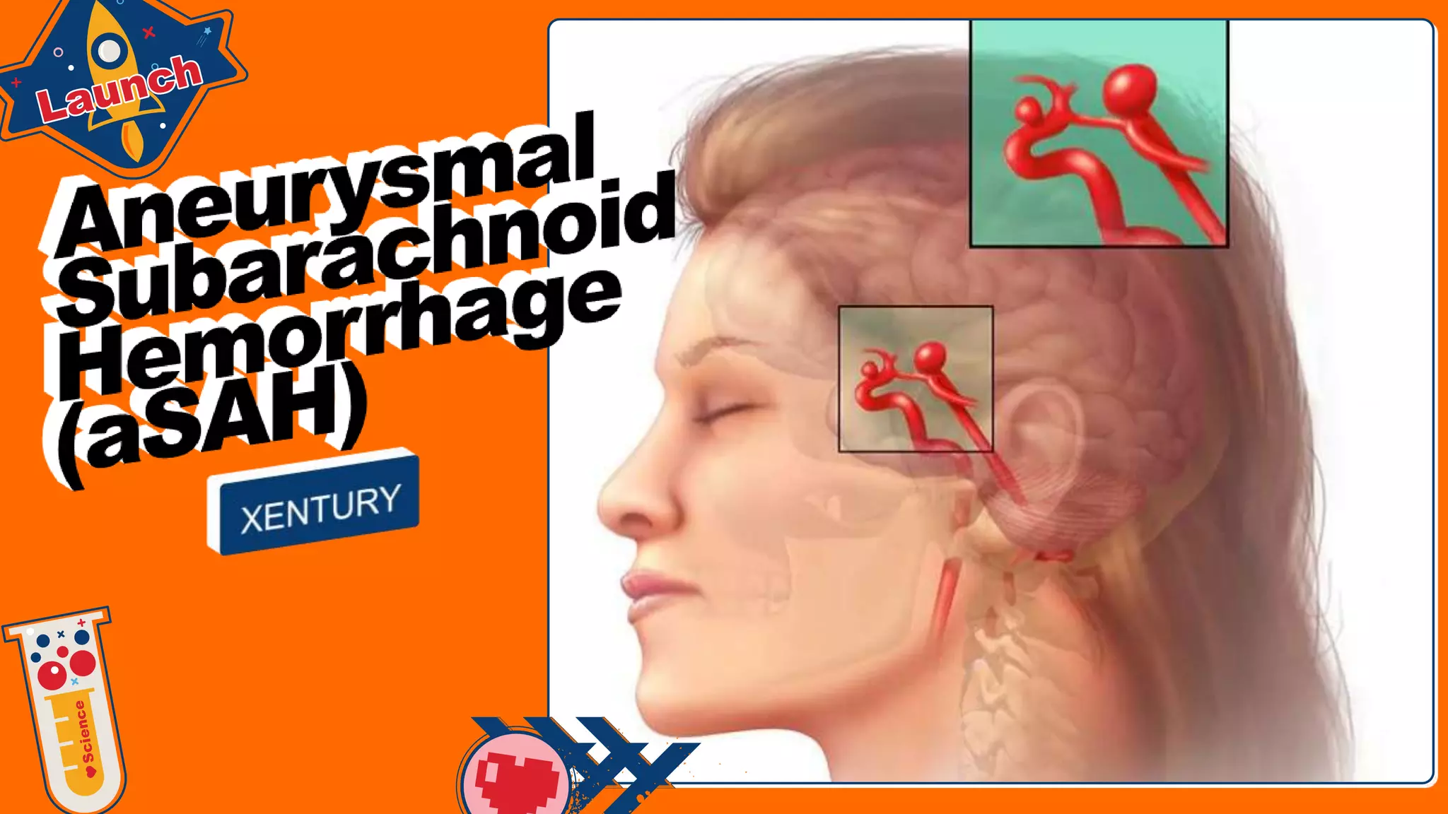 Aneurysmal subarachnoid hemorrhage presentation | PPTX