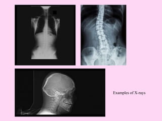X-RAY | PPTX