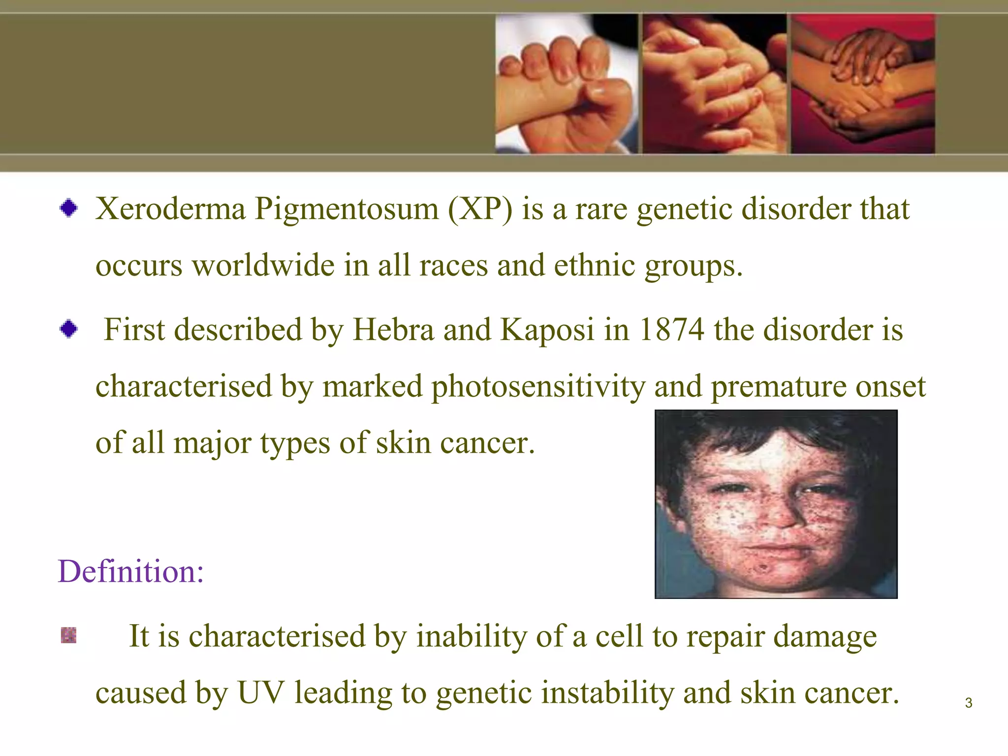 Xeroderma Pigmentosum | PPTX