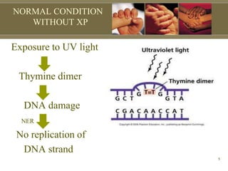 Xeroderma Pigmentosum Gene Mutation