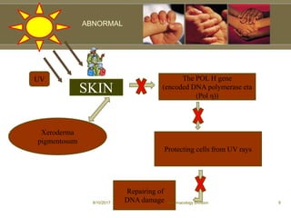Xeroderma Pigmentosum Gene Mutation