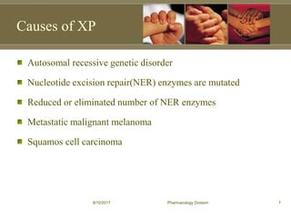 Xeroderma Pigmentosum Treatment