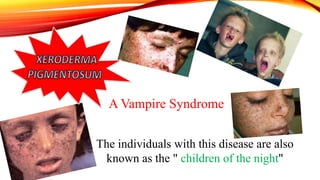 Xeroderma pigmentosum | PPT