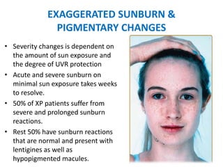 XERODERMA PIGMENTOSUM.pptx