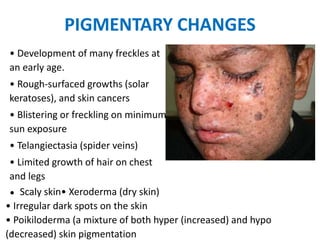 XERODERMA PIGMENTOSUM.pptx