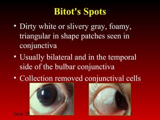 Bitots Spots