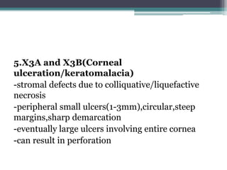 Xerophthalmia | PPTX