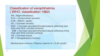 Xerophthalmia.pptx