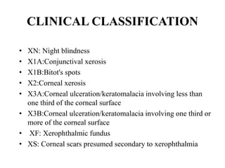 Xerophthalmia.pptx