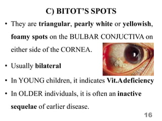 xeropthalmia signs and symptoms .How to prevent and treat effectively | PPT