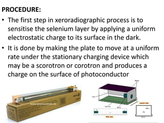 Xeroradiography | PPTX