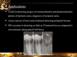Xeroradiography | PPTX