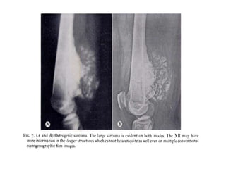 Xeroradiography | PPTX