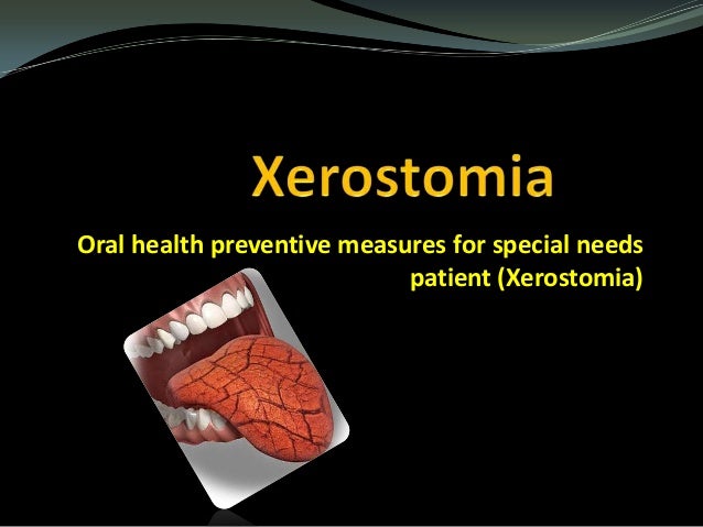 Xerostomia Adalah