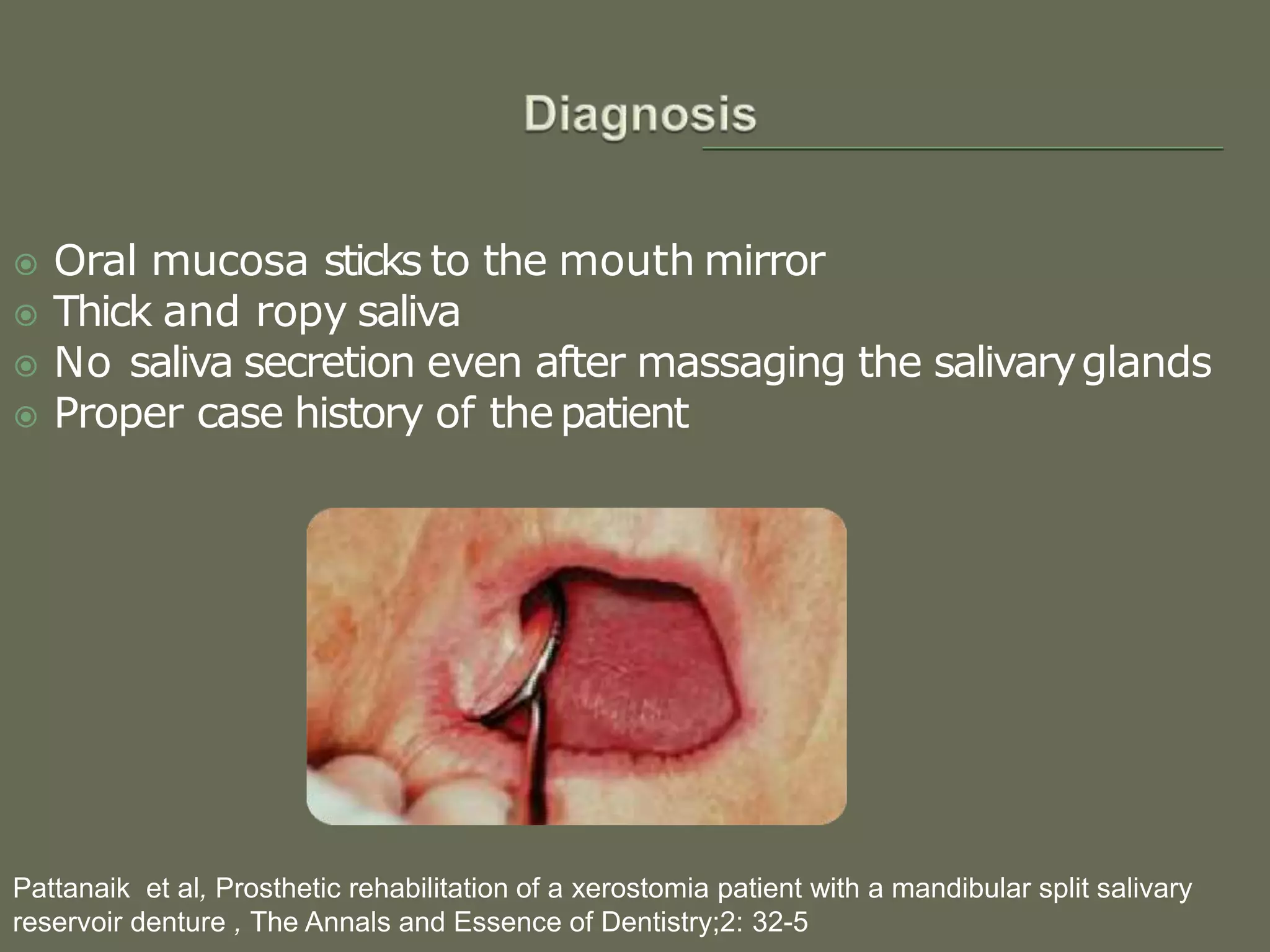 Split denture prosthesis for xerostomia- Journal Club | PPTX