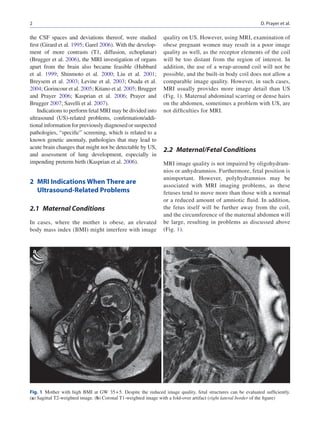 Fetal MRI | PDF
