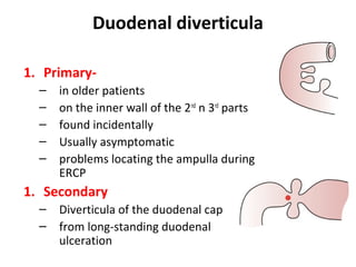 Colonic diverticulosis neo | PPT