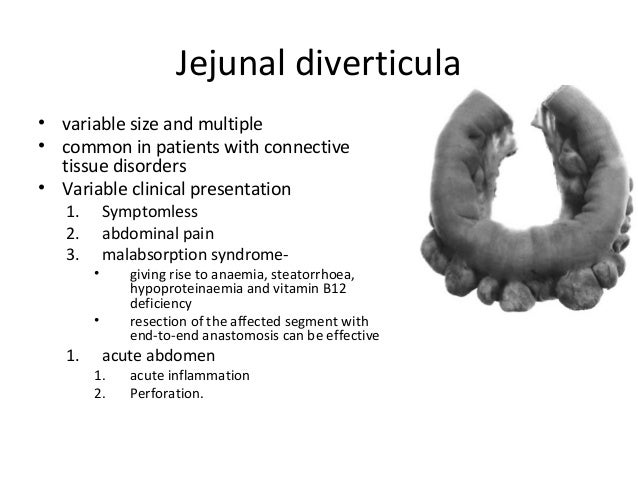 Colonic diverticulosis neo