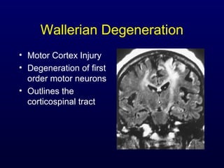Anatomy of Motor system2 | PPT