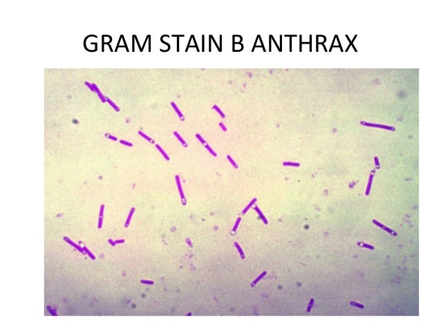 [Micro] gram positive spore bearing rods