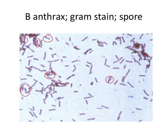 [Micro] gram positive spore bearing rods
