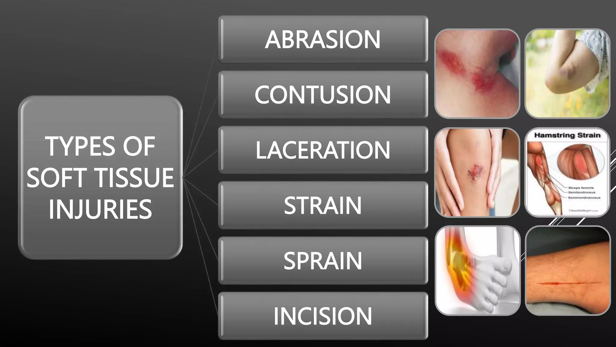 XII Chapter VIIIPhysiology & injuries in sports.pptx