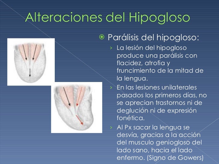 Nervio Hipogloso