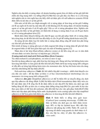 Xi mang gan nha khoa | PDF