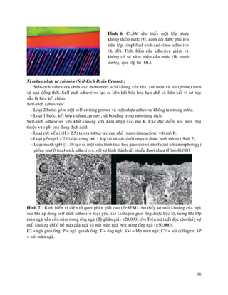 Xi mang gan nha khoa | PDF