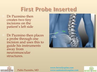 XLIF by Pablo Pazmino MD | PPT