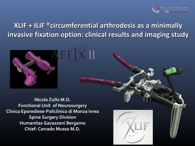 XLIF + ILIF ®circumferential arthrodesis as a minimally invasive | PPT