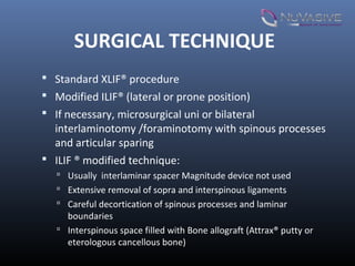 XLIF + ILIF ®circumferential arthrodesis as a minimally invasive | PPT