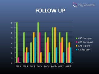 XLIF + ILIF ®circumferential arthrodesis as a minimally invasive | PPT