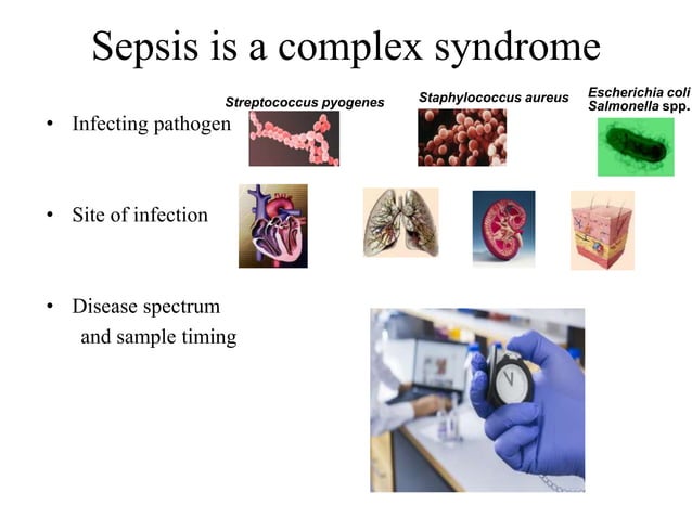 New diagnostic tools in sepsis - Adam Linder - SSAI2017 | PPT