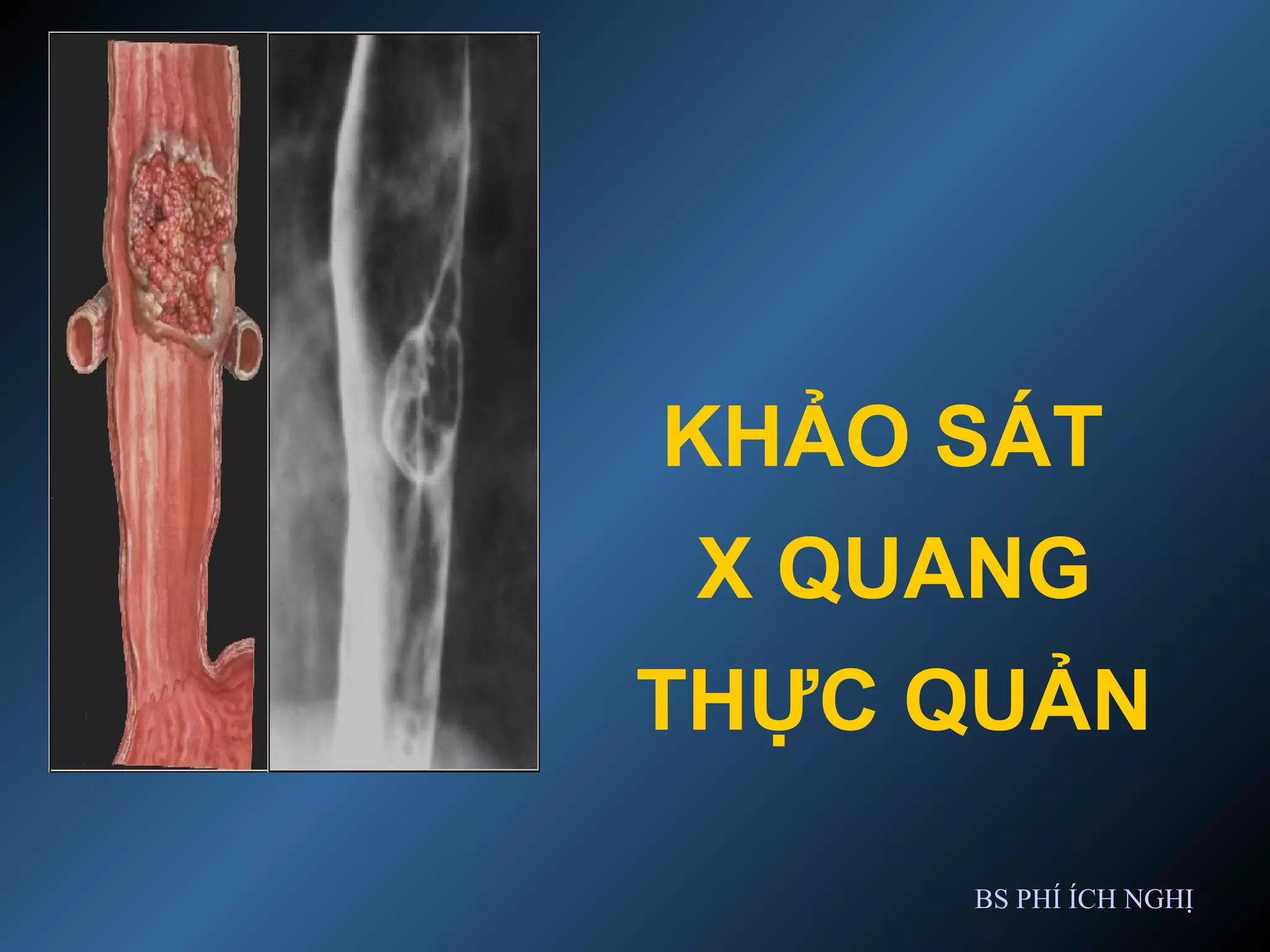 Xq thuc quan | PPT