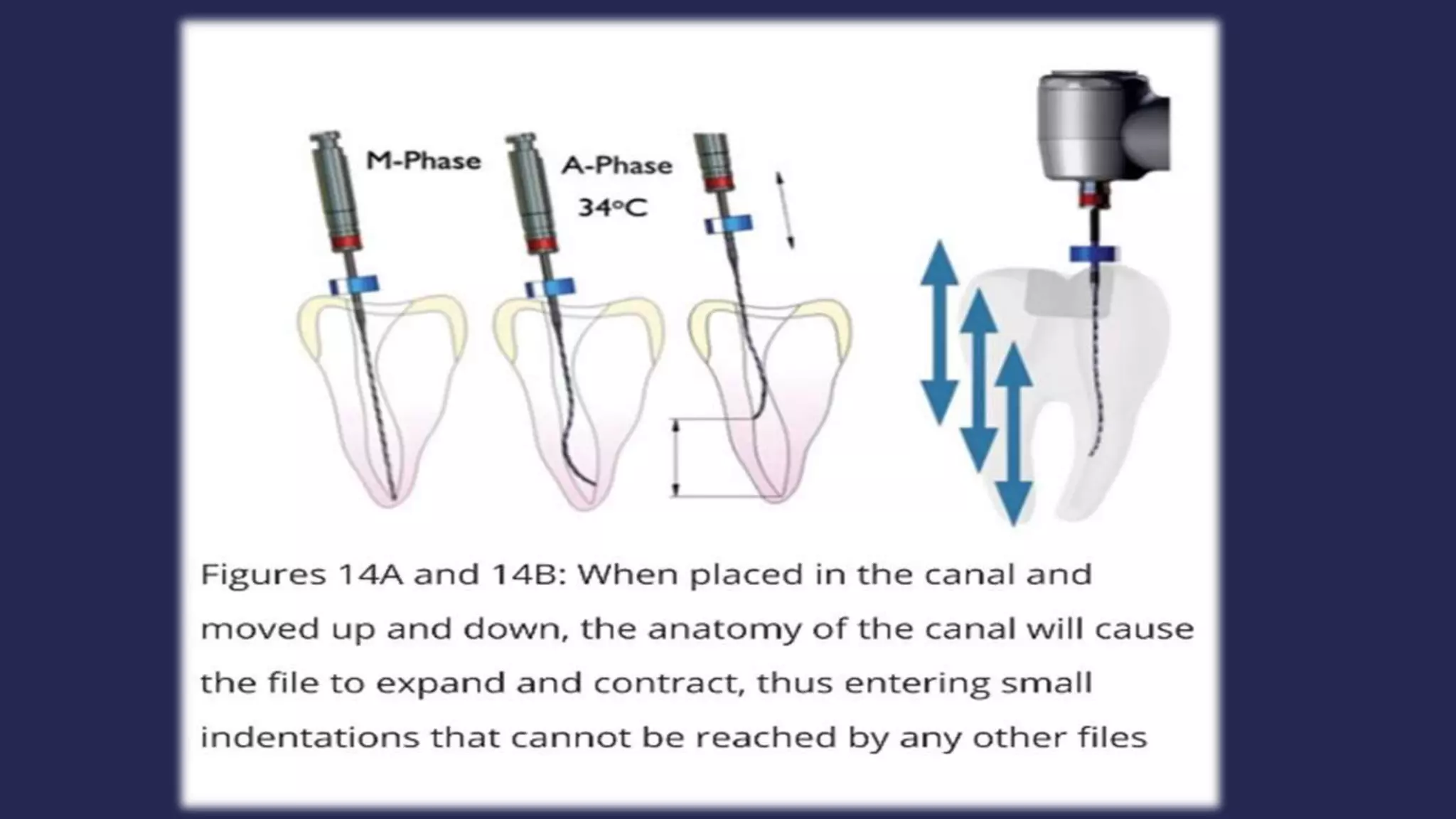 XP-Endo file / Dr.Sarah Alkhateeb | PPTX