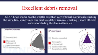 XP-Endo file / Dr.Sarah Alkhateeb | PPTX