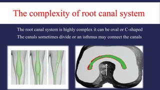 XP-Endo file / Dr.Sarah Alkhateeb | PPTX