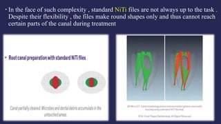XP-Endo file / Dr.Sarah Alkhateeb | PPTX