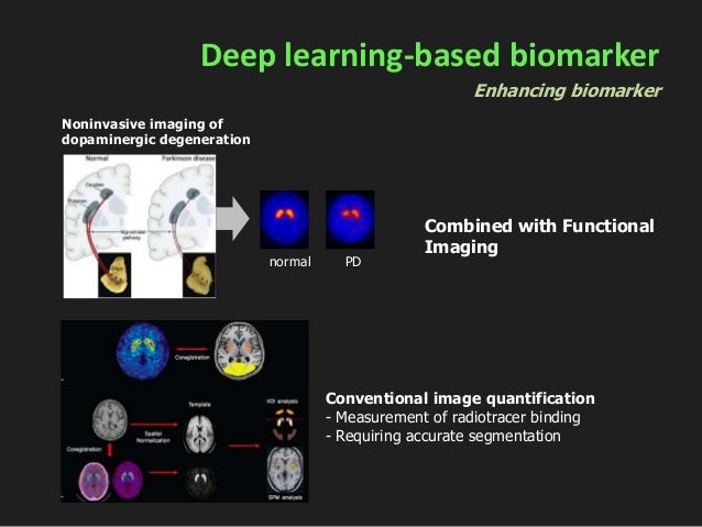 Deep learning application to medical imaging: Perspectives as a physi…