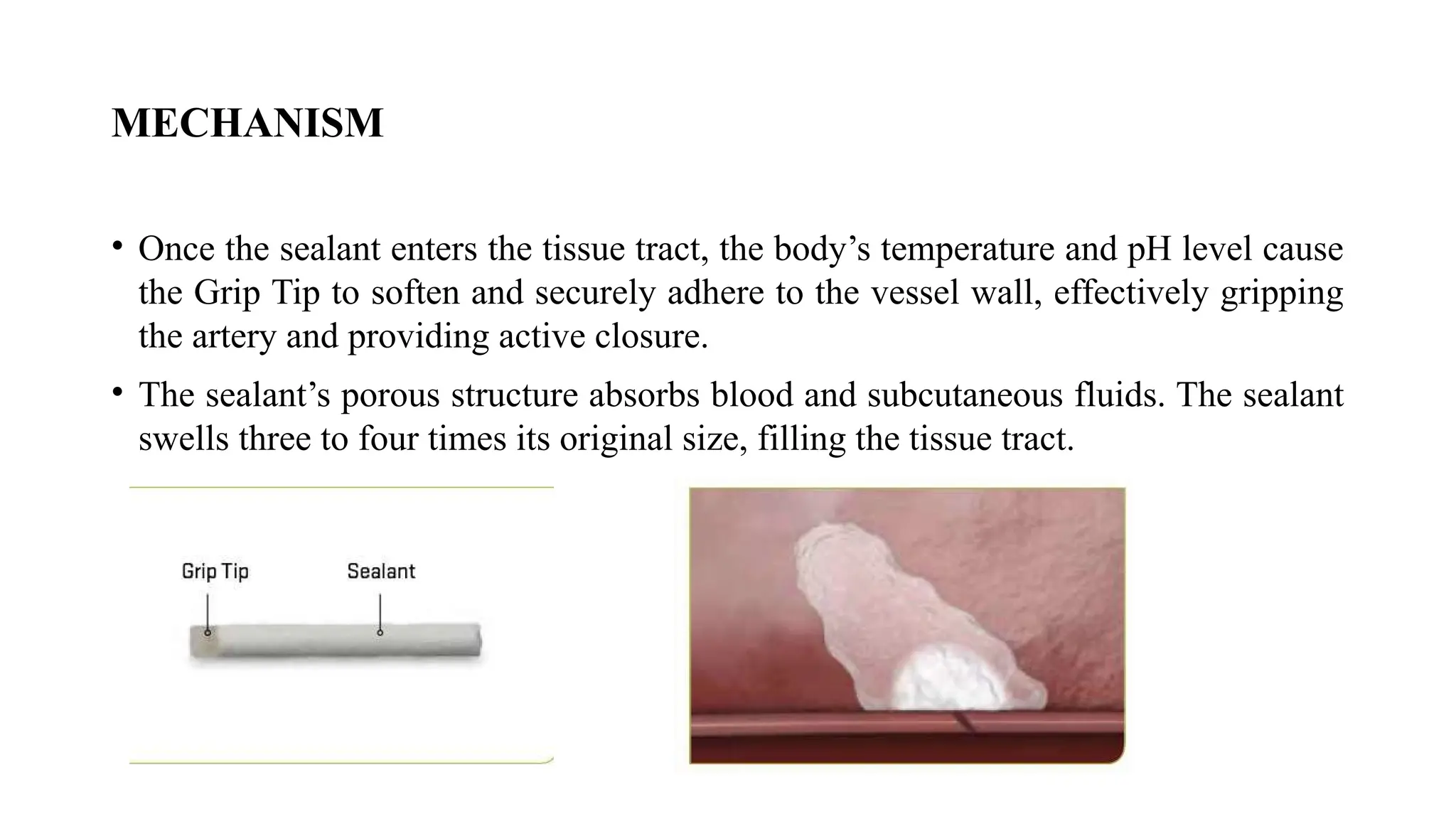 VASCULAR_DEVICE_CLOSURE., cardiologypptx | PPT