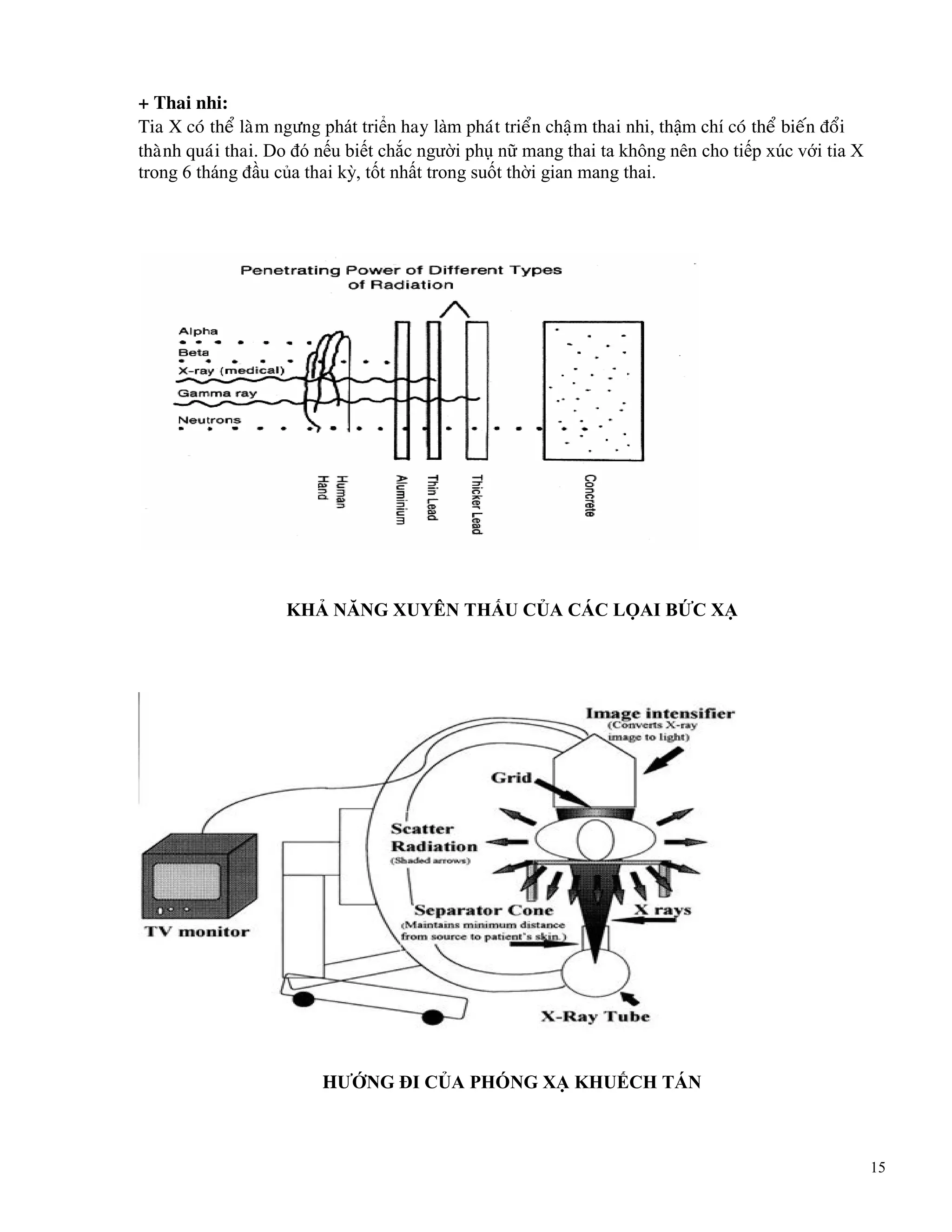 Xq ky thuat x quang quy uoc, nguyen doan cuong | PDF