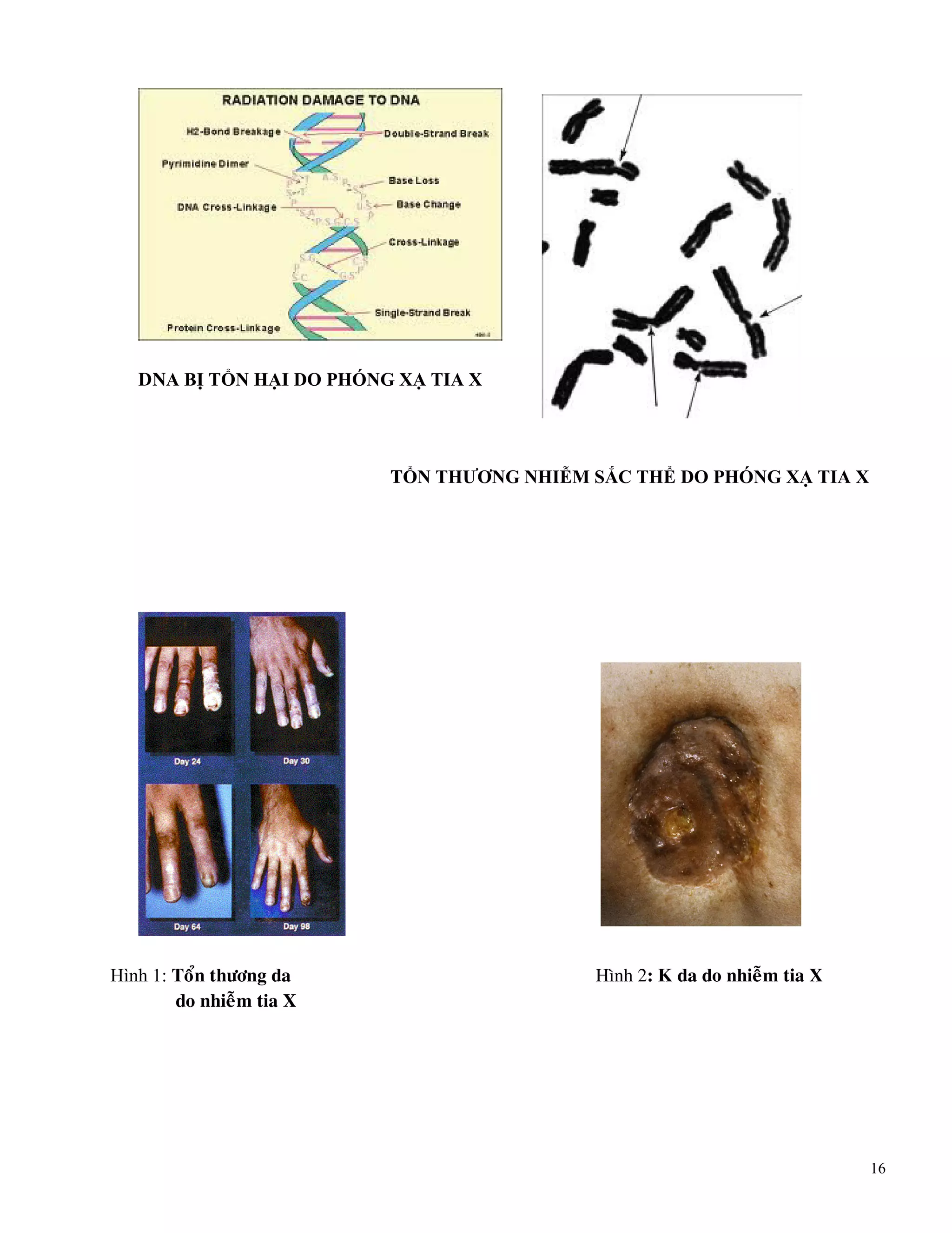Xq ky thuat x quang quy uoc, nguyen doan cuong | PDF