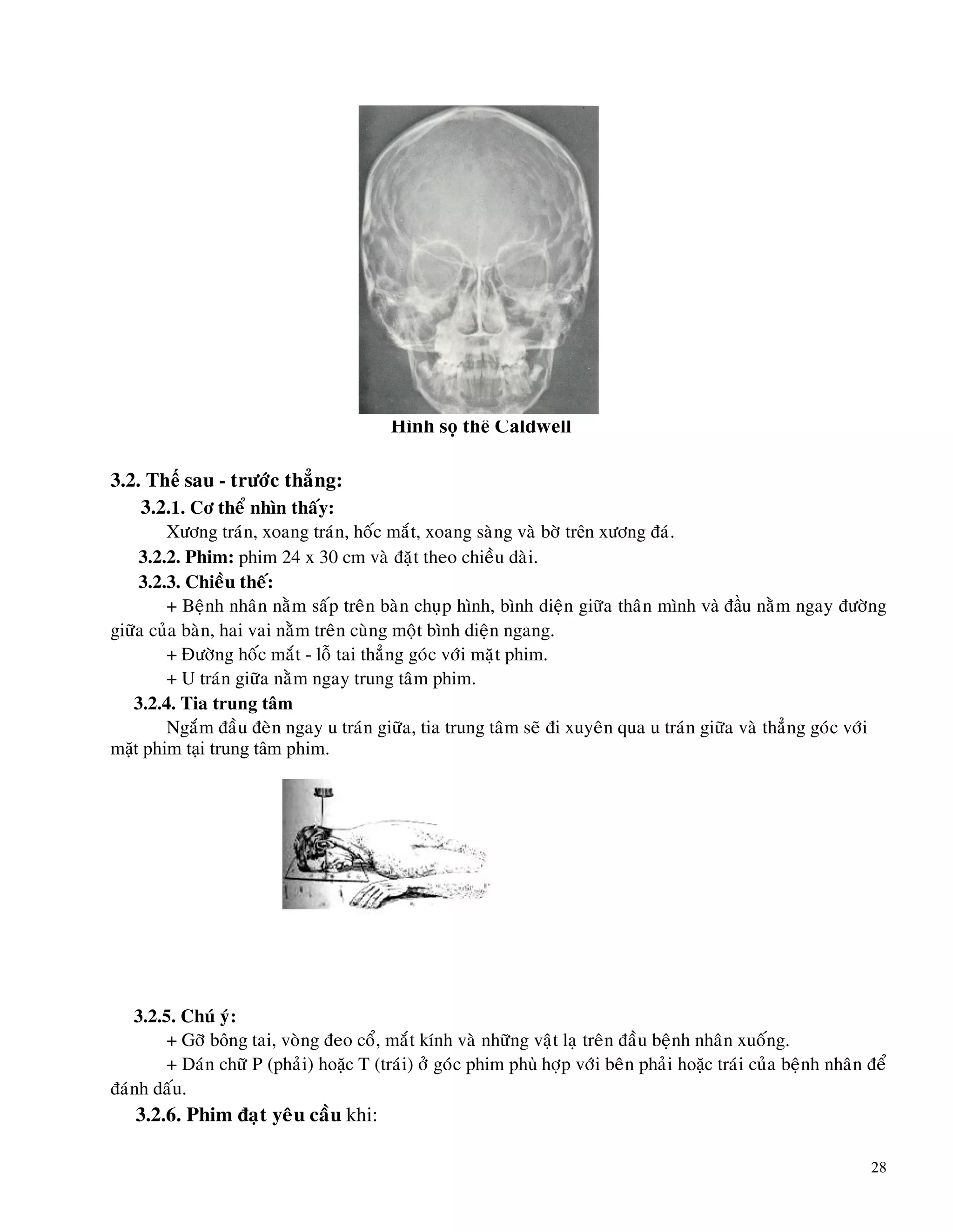 Xq ky thuat x quang quy uoc, nguyen doan cuong | PDF