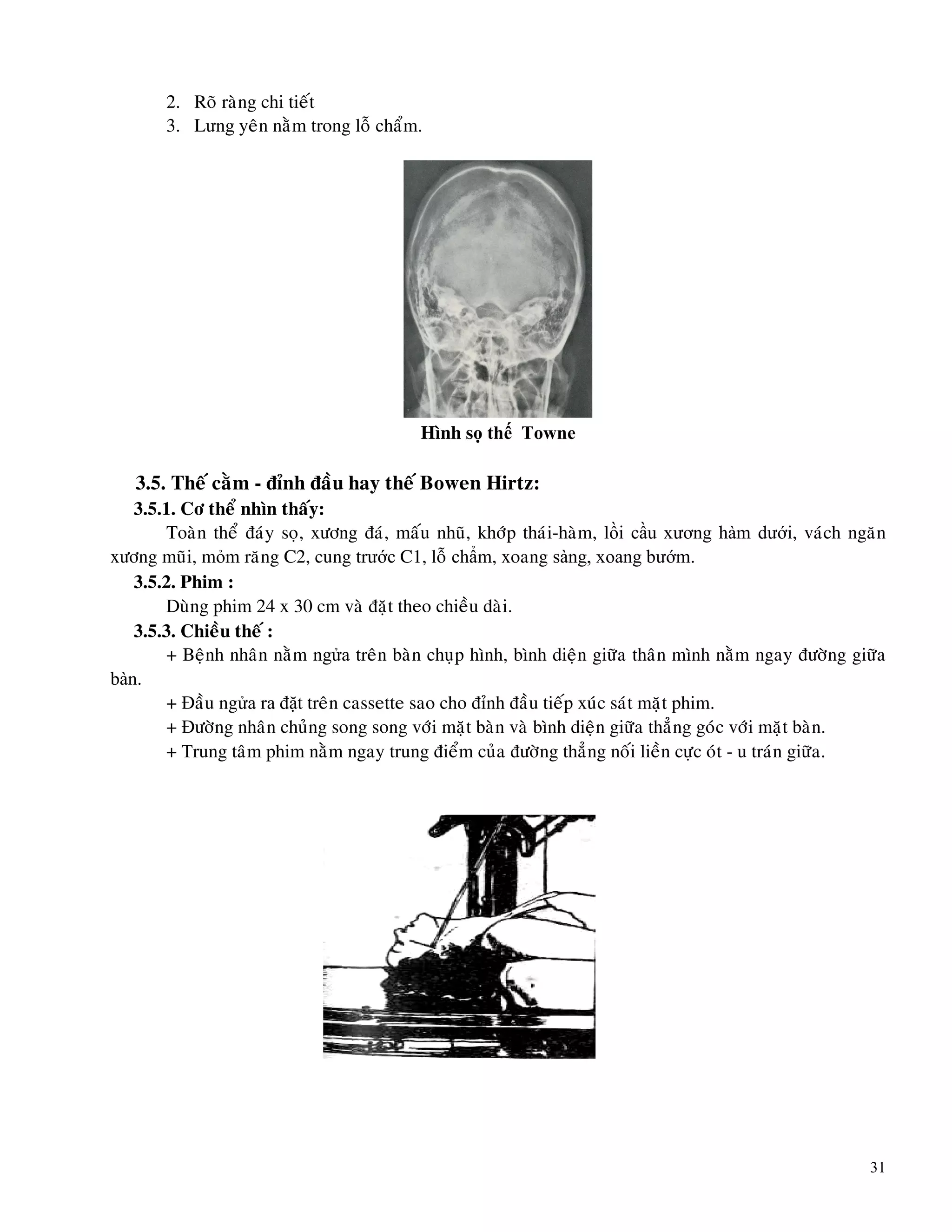 Xq ky thuat x quang quy uoc, nguyen doan cuong | PDF