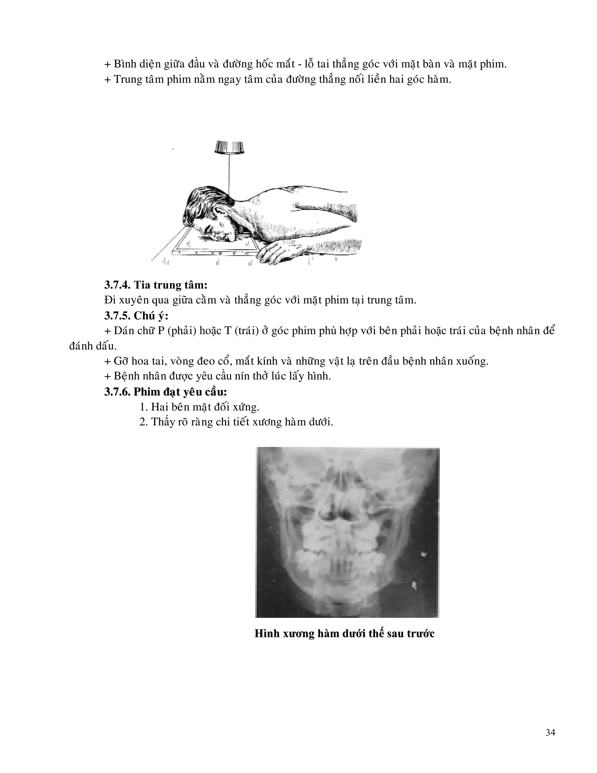 Xq ky thuat x quang quy uoc, nguyen doan cuong | PDF