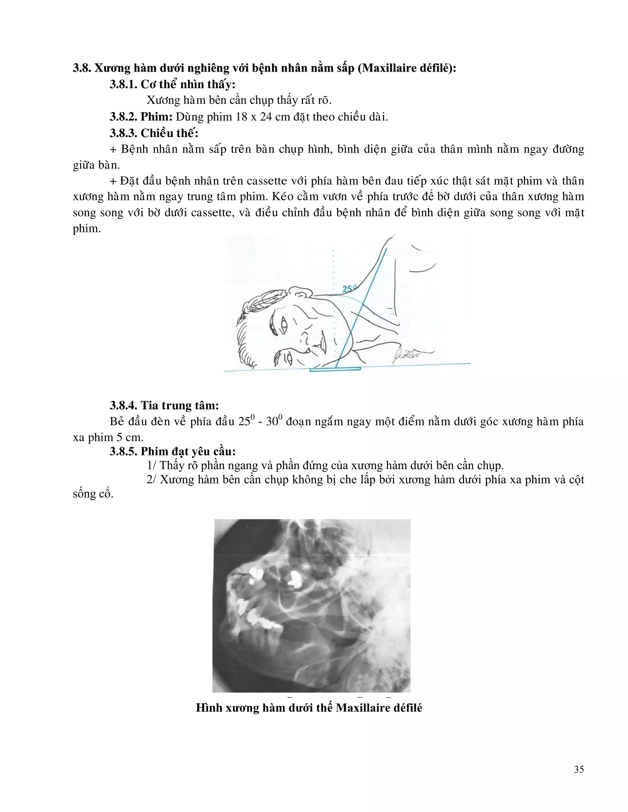 Xq ky thuat x quang quy uoc, nguyen doan cuong | PDF