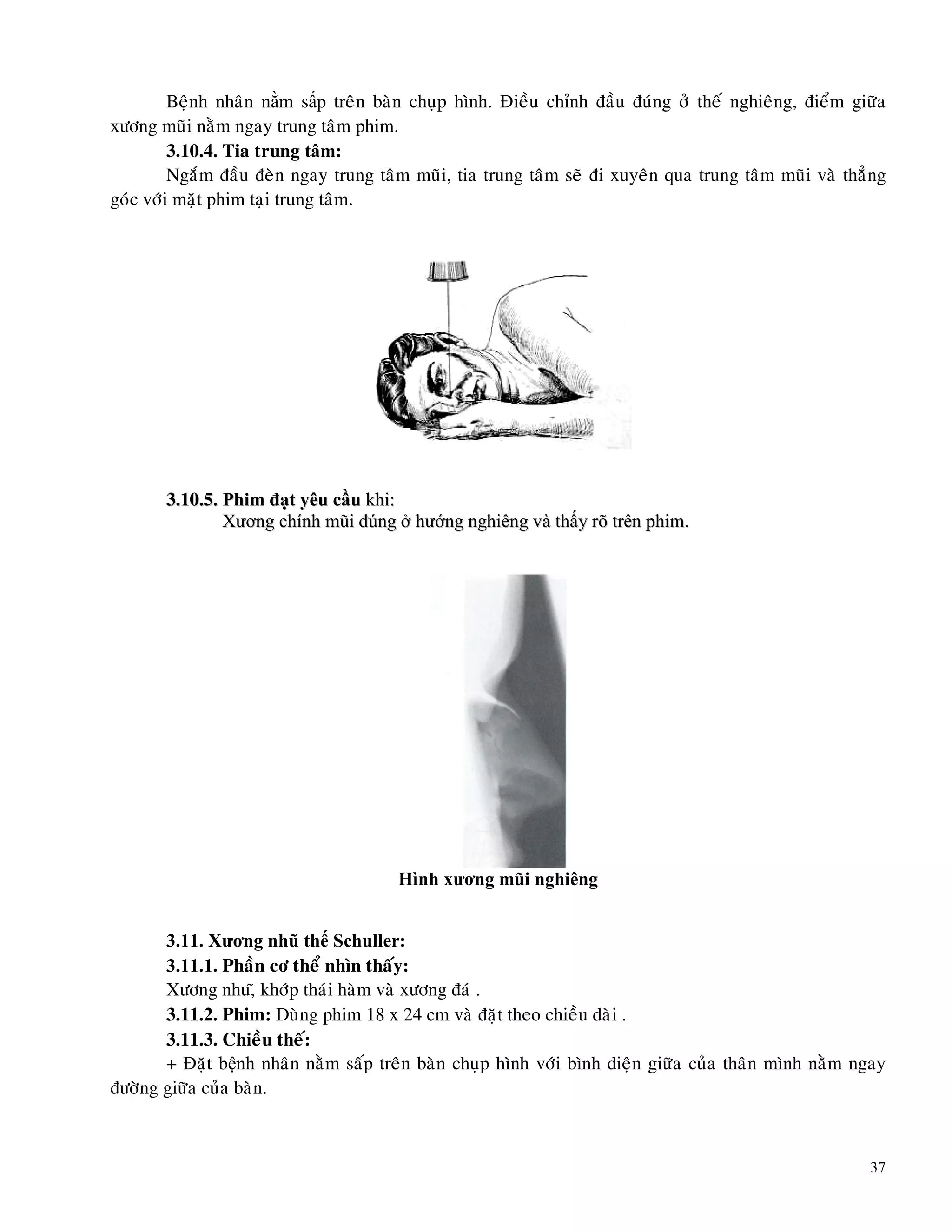 Xq ky thuat x quang quy uoc, nguyen doan cuong | PDF